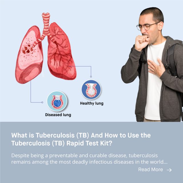 What is Tuberculosis (TB) and How to Use the Tuberculosis (TB) Rapid ...