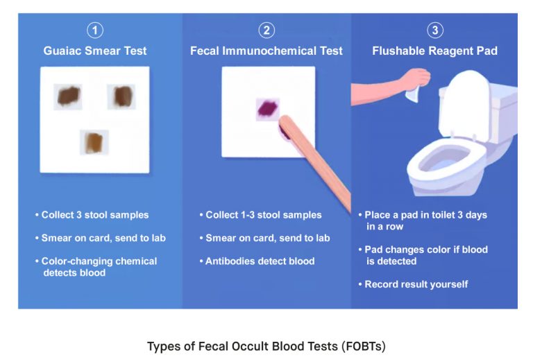 What Is Fecal Occult Blood and How to Use the Fecal Occult Blood Test ...