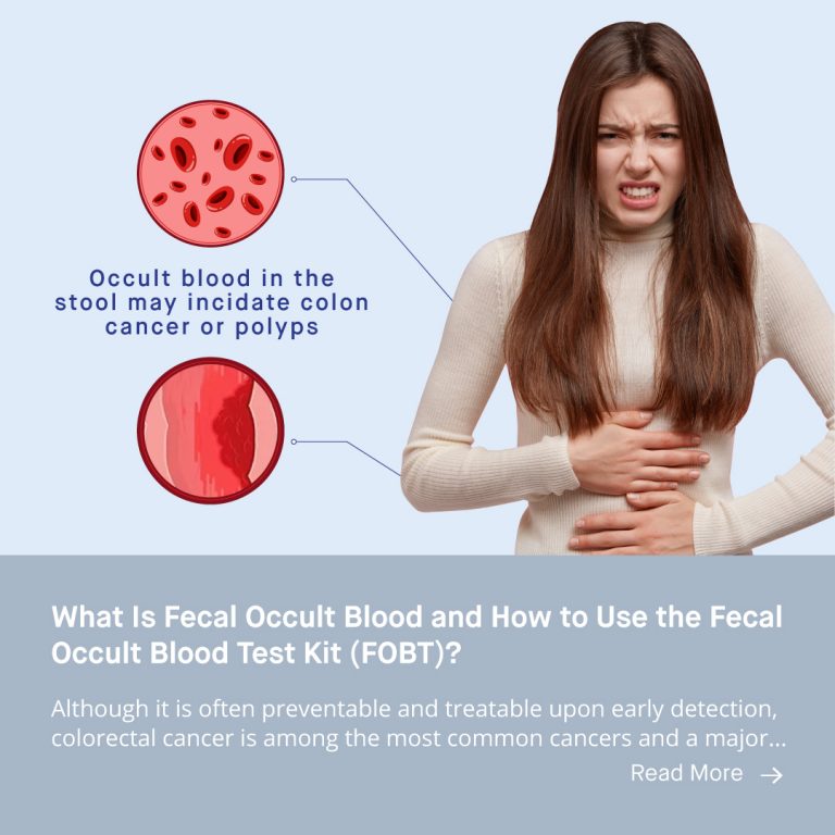 What Is Fecal Occult Blood and How to Use the Fecal Occult Blood Test ...