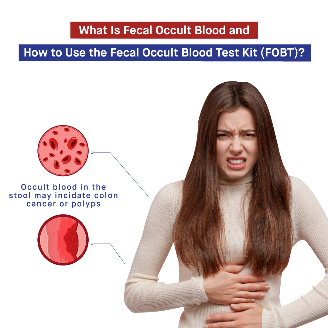 What Is Fecal Occult Blood and How to Use the Fecal Occult Blood Test ...