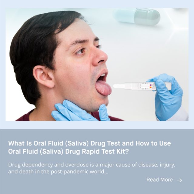 What is Oral Fluid (Saliva) Drug Test and How to Use Oral Fluid (Saliva ...