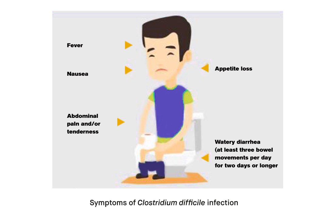 What is Clostridium difficile (C. difficile) Infection and How to Use ...