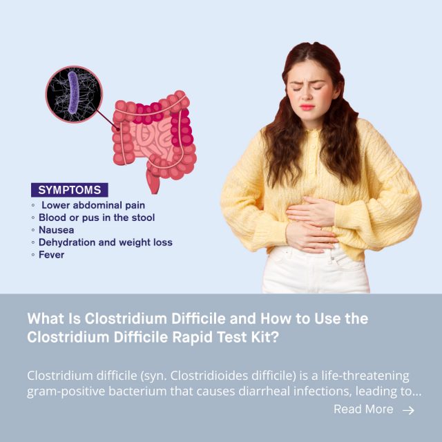 What is Clostridium difficile (C. difficile) Infection and How to Use ...