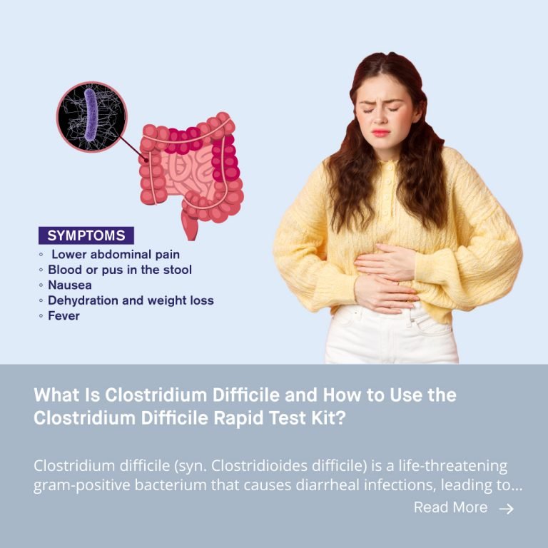 What is Clostridium difficile (C. difficile) Infection and How to Use ...