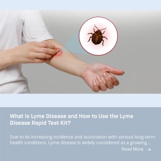 What is Lyme Disease and How to Use the Lyme Disease Rapid Test Kit ...