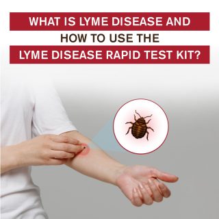 What is Lyme Disease and How to Use the Lyme Disease Rapid Test Kit ...