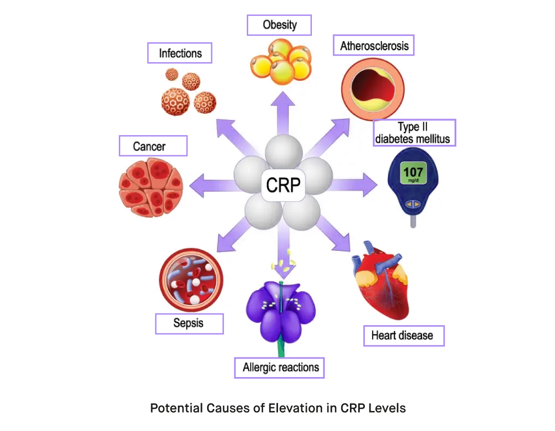 What is C-reactive Protein (CRP) and How to Use C-reactive Protein (CRP ...