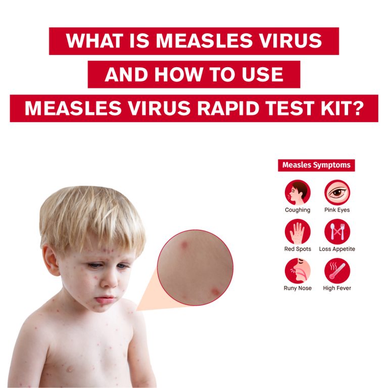 What is Measles Virus and How to Use Measles Virus Rapid Test Kit?