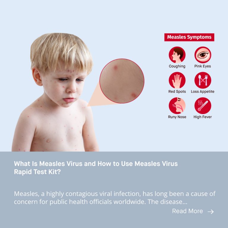 What is Measles Virus and How to Use Measles Virus Rapid Test Kit?