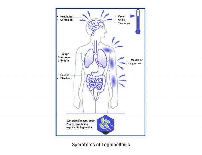What is Legionellosis (Legionnaires' Disease and Pontiac Fever) and How ...