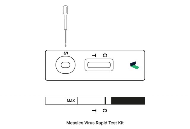 What is Measles Virus and How to Use Measles Virus Rapid Test Kit?