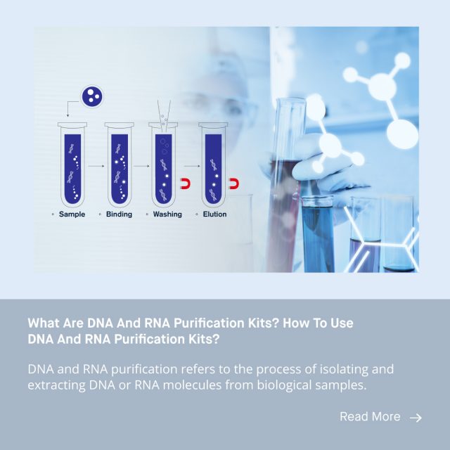 What are DNA and RNA Purification Kits? How to Use DNA and RNA ...