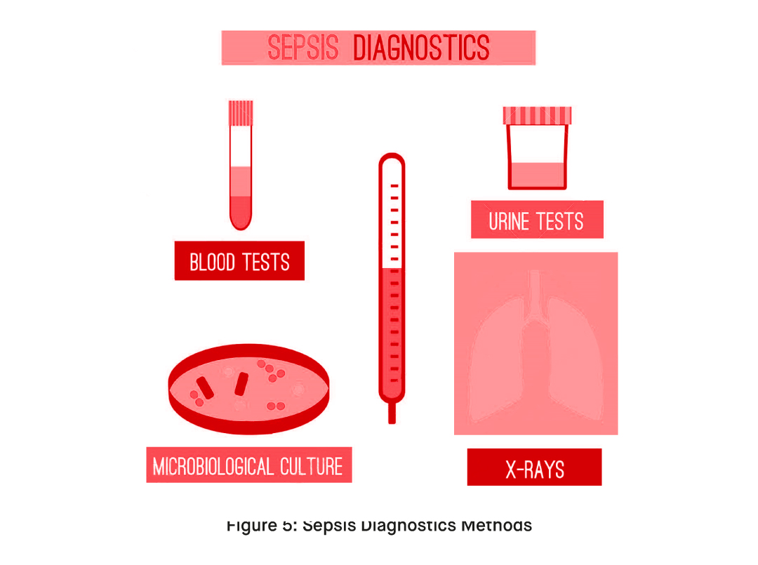 What is Sepsis? How to Use Sepsis Real-Time qPCR Panel Detection Kit ...