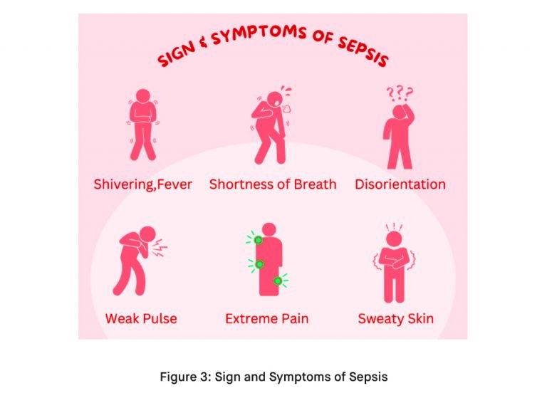 What is Sepsis? How to Use Sepsis Real-Time qPCR Panel Detection Kit? - Vitrosens Biotechnology ...