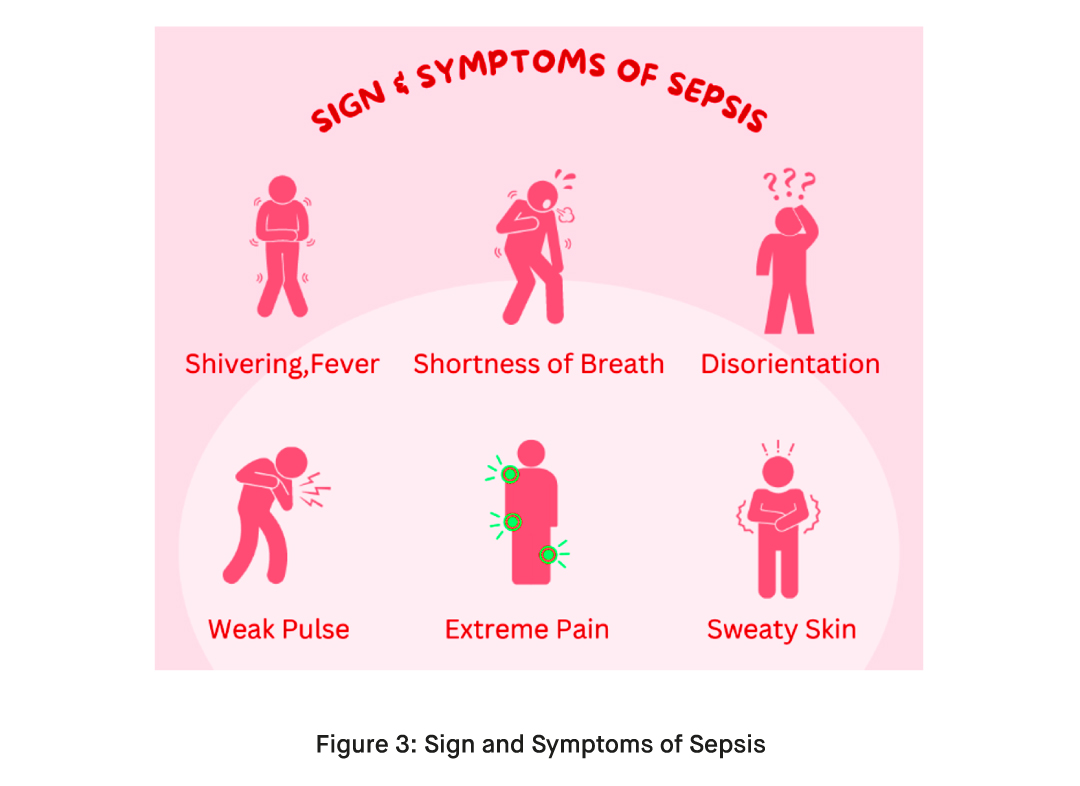 What is Sepsis? How to Use Sepsis Real-Time qPCR Panel Detection Kit ...
