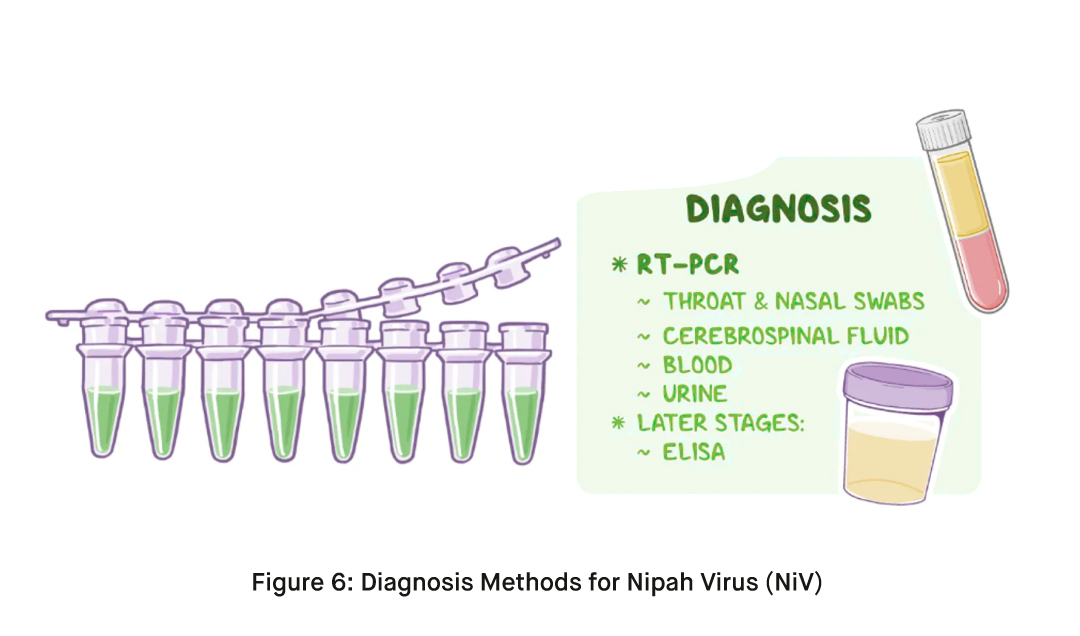 What is Nipah Virus (NiV) Causing the Outbreak in India? How to Use ...