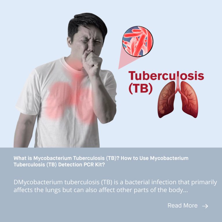 What is Mycobacterium Tuberculosis (TB)? How to Use Mycobacterium ...