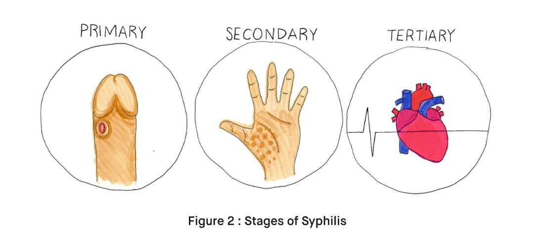 What is Syphilis? How to Use Syphilis Rapid Test Kit? - Vitrosens ...