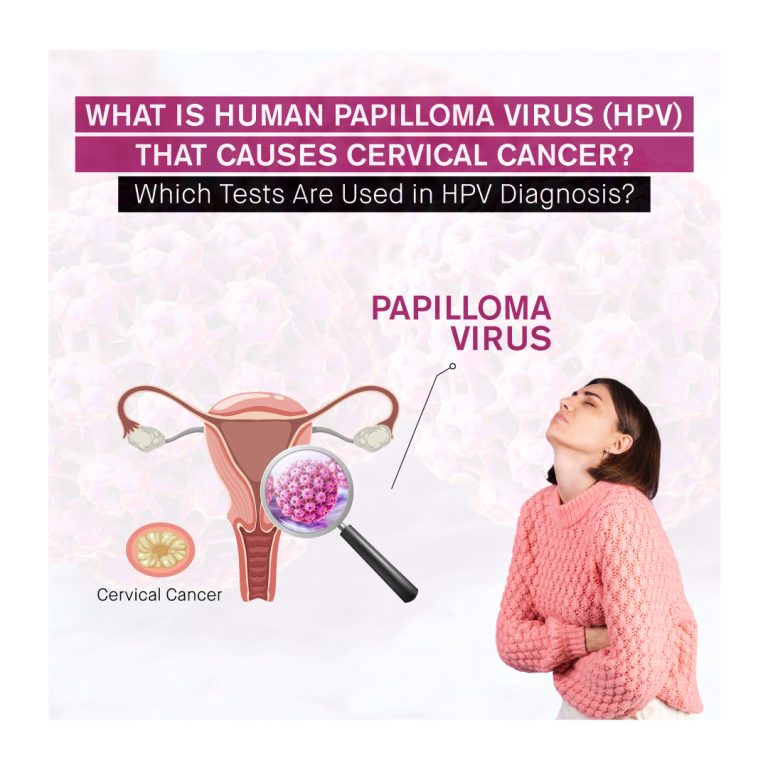 What is Human Papilloma Virus (HPV) That Causes Cervical Cancer? Which ...