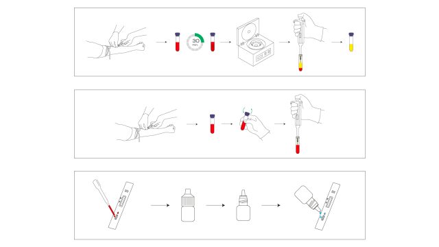 Pancreas and Liver Cancers: Enhancing Diagnosis with CEA Rapid Test Kit ...