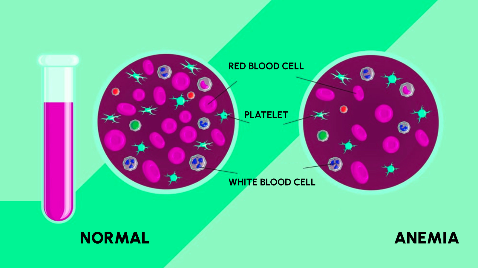 The Importance of Ferritin and Rapid Diagnosis Using Ferritin Rapid ...