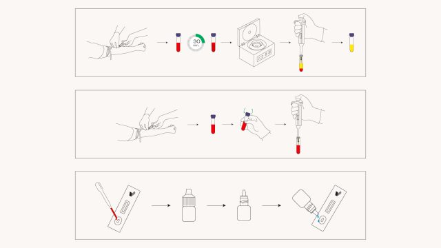 Syphilis Testing: PCR vs. Antibody Tests for Accurate Diagnosis